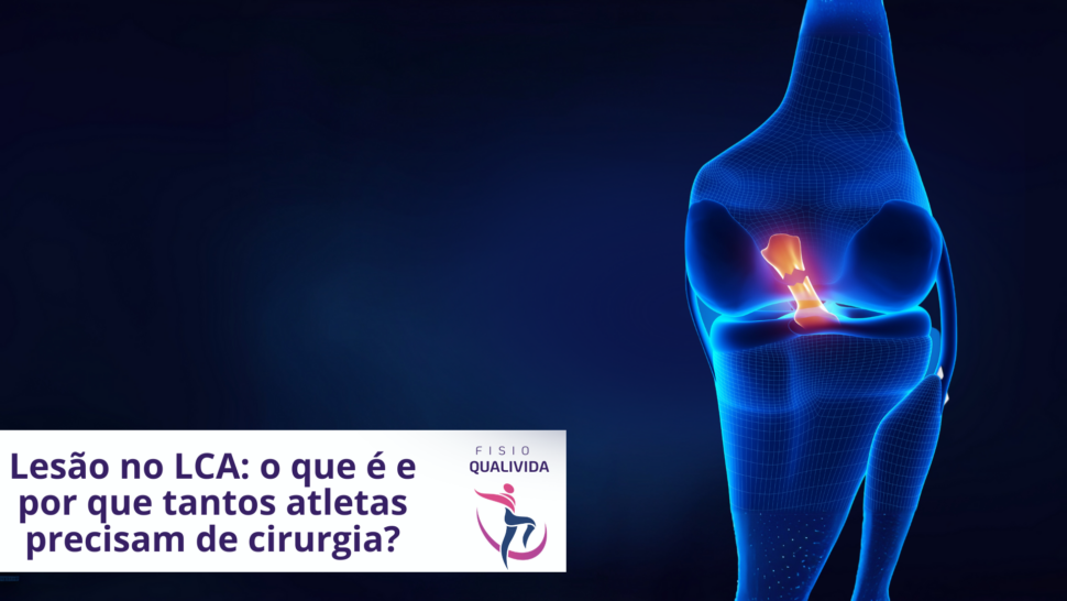 Lesão LCA: o que é e por que atletas precisam de cirurgia?